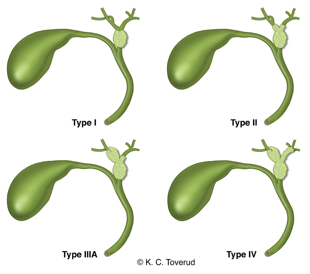 Kirurgisk behandling - Helsedirektoratet